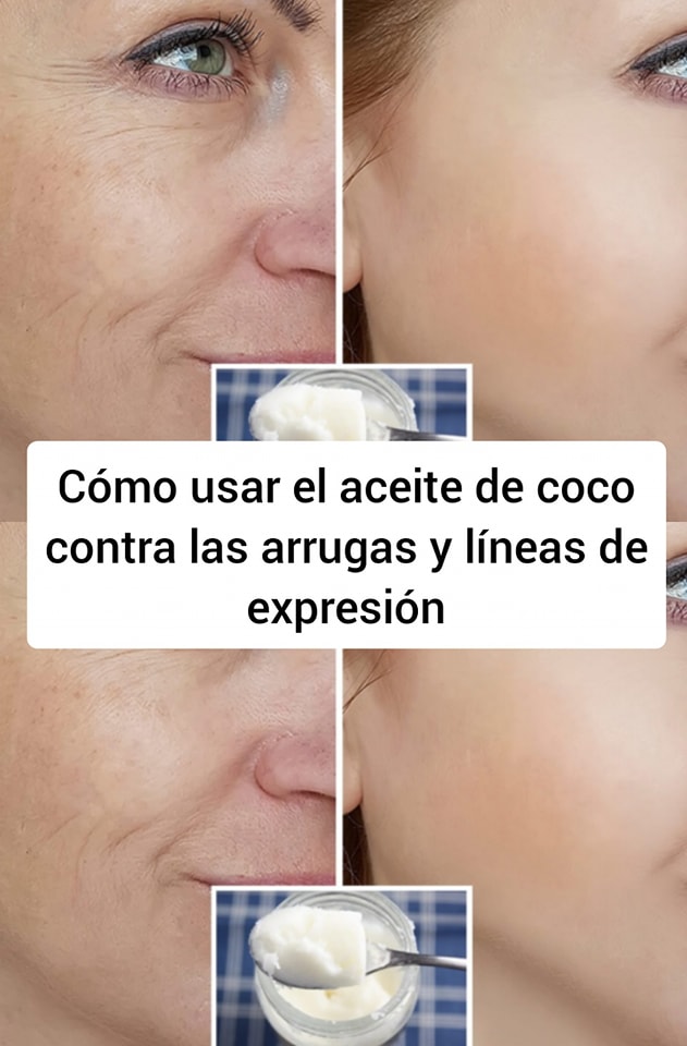 Cómo usar el aceite de coco contra las arrugas y líneas de expresión ...